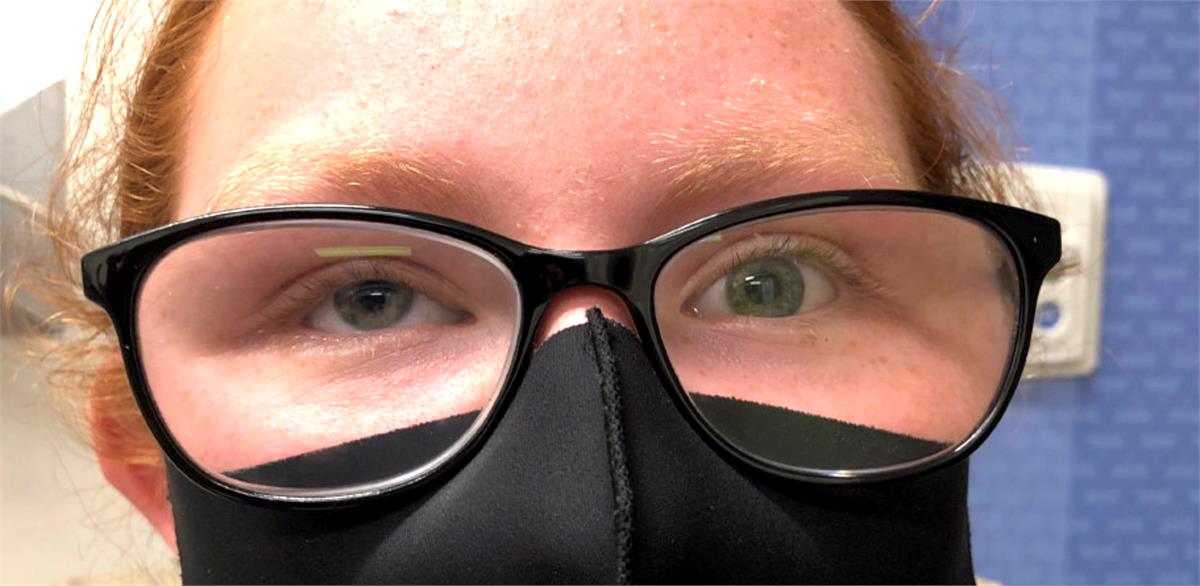 Dissociated Vertical Deviation - American Association for Pediatric ...