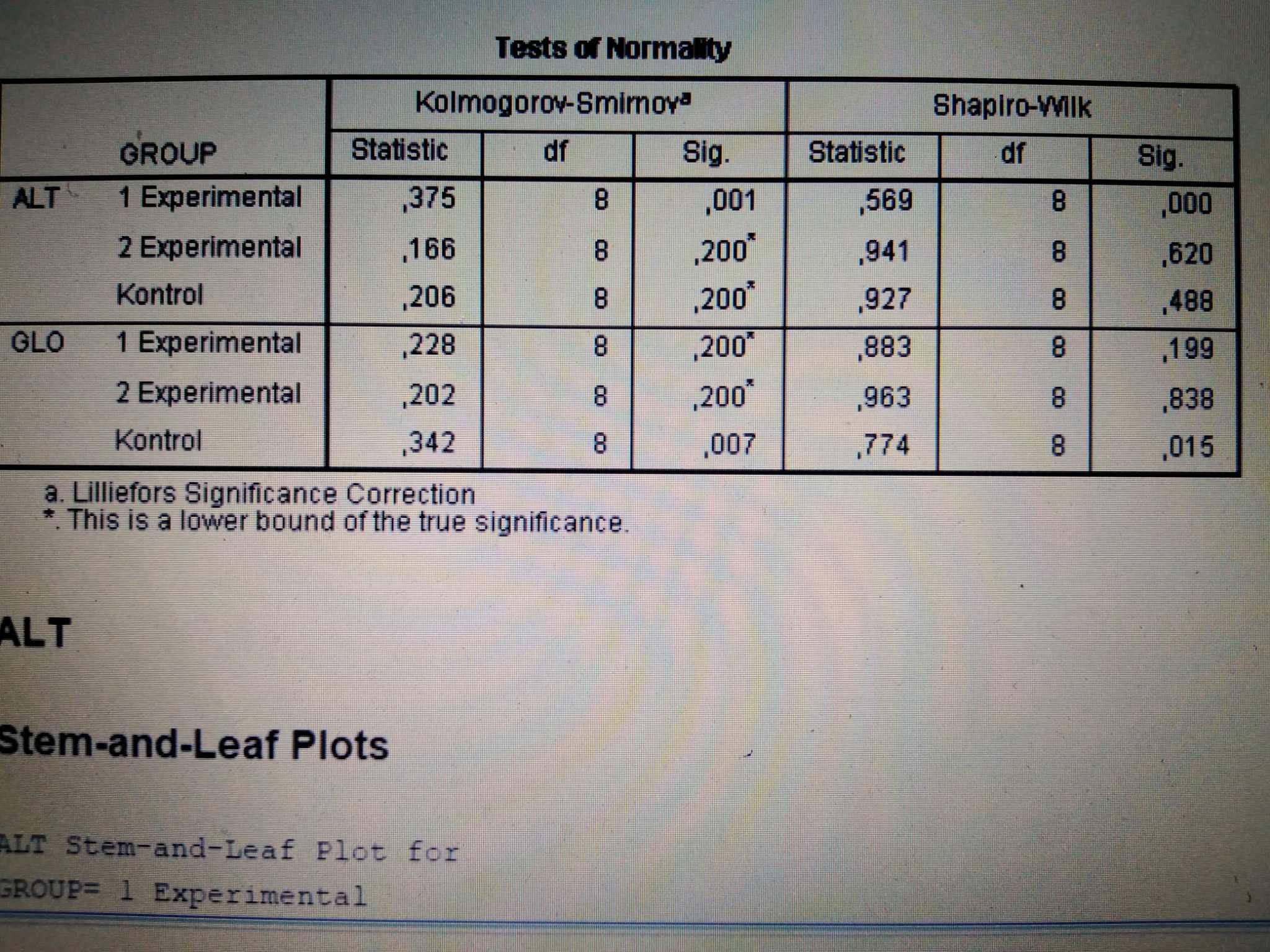 Test for normality of distribution (Explore) SPSS | SPSS Statistics