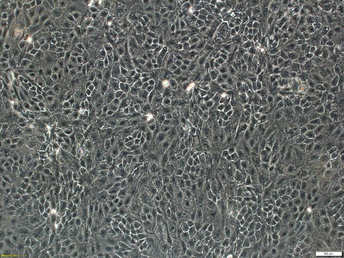 Under the Microscope Amnion Epithelial Cells
