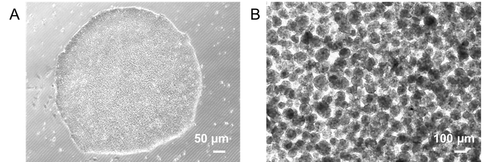 Under the Microscope: Human Pluripotent Stem Cell-Derived Pancreatic ...