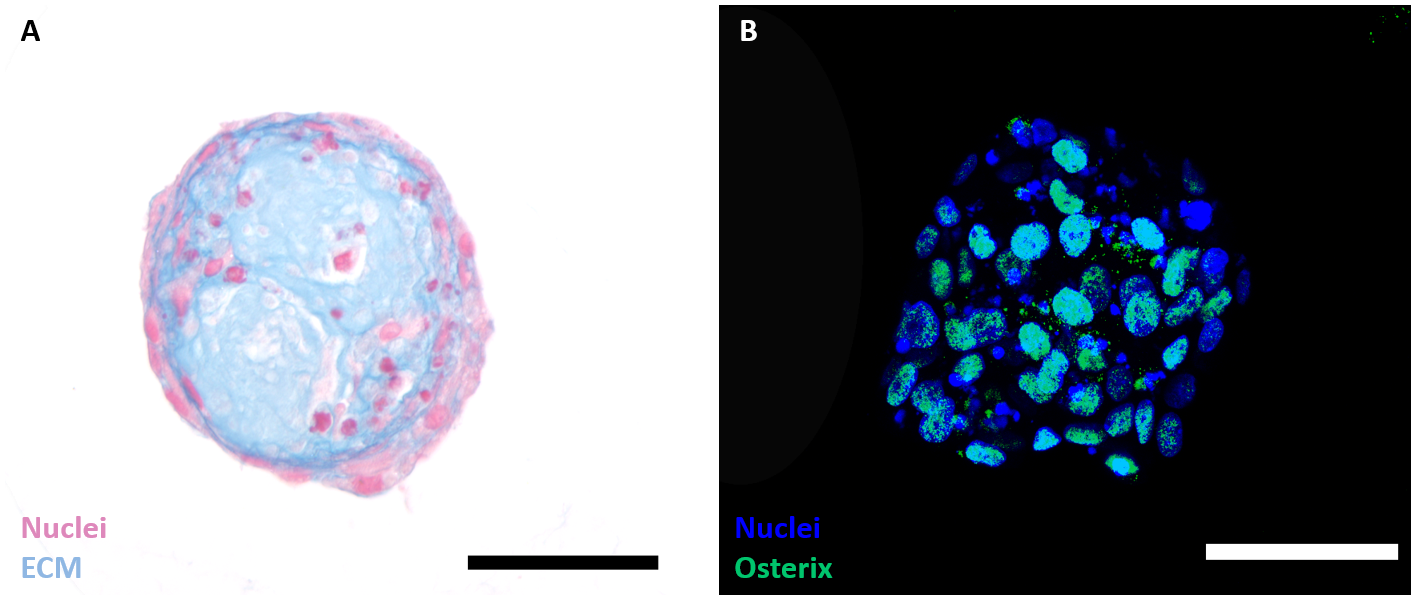 Under the Microscope: Callus Organoids derived from Human Periosteal Cells