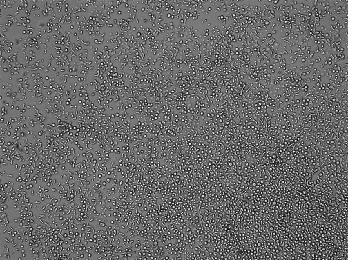 Under the Microscope: CAR-NK Cells