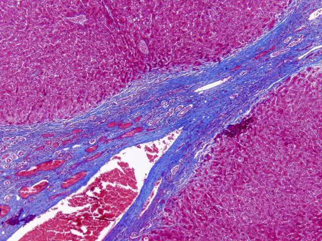 A Guide to Special Stains Part 2