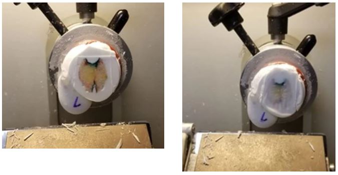 Full Section Mounts for Mohs Micrographic Surgery Using the Reverse ...