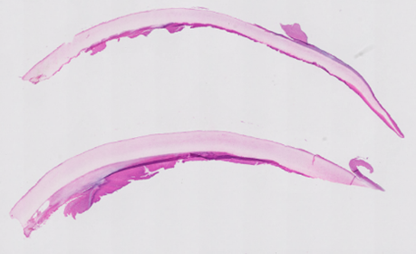 Nail Protocol: From H&E to IHCs Getting Nails to Stick