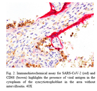 Using Immunohistochemistry Double-Labeling to Detect SARS-Cov-2 Infection
