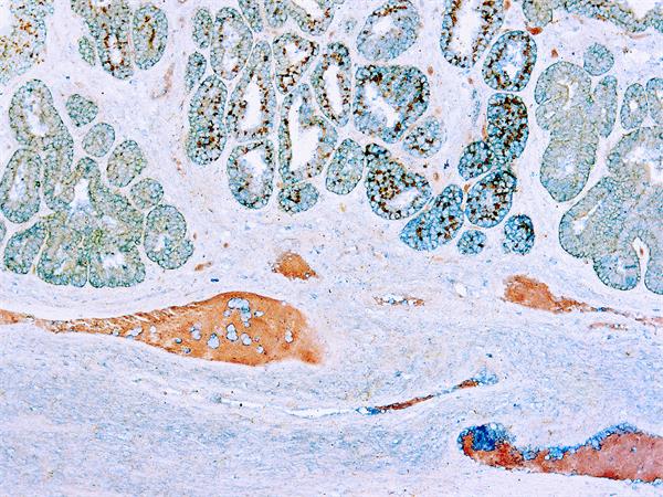 Art of the Stain Voting - National Society for Histotechnology