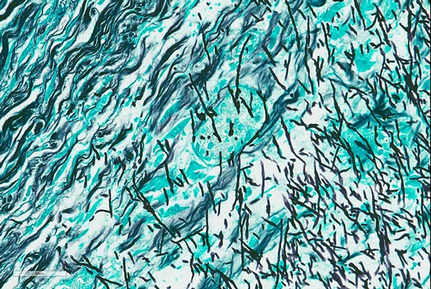 Types of Silver Stains