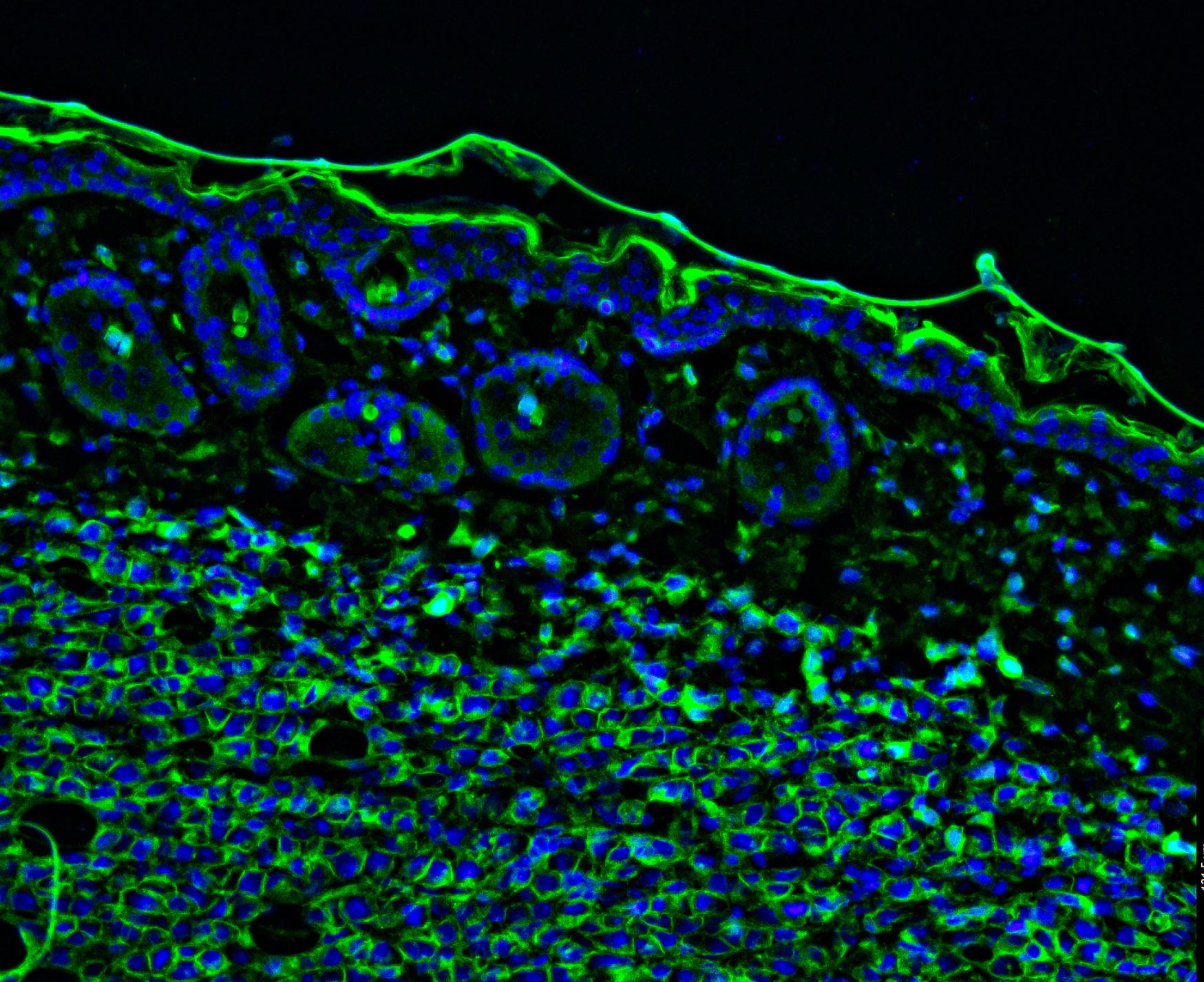 PRAME: What Is It and Should My Lab Be Using It?
