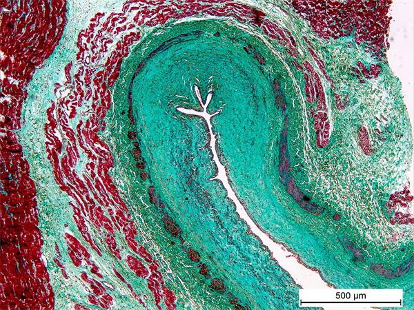 Art of the Stain Voting - National Society for Histotechnology