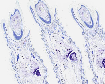 A Nail Specimen Technique