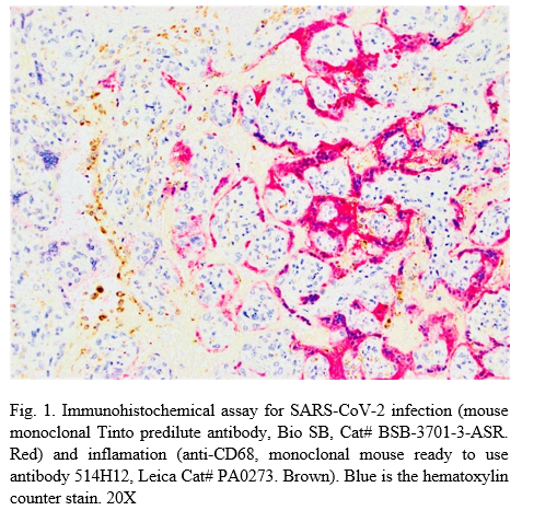 Using Immunohistochemistry Double-Labeling to Detect SARS-Cov-2 Infection