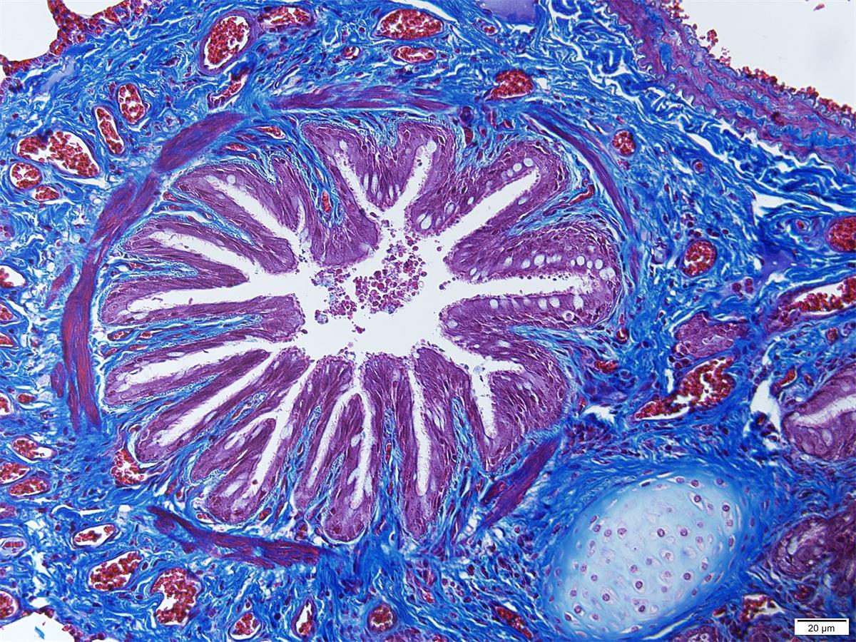 Art of the Stain Voting - National Society for Histotechnology