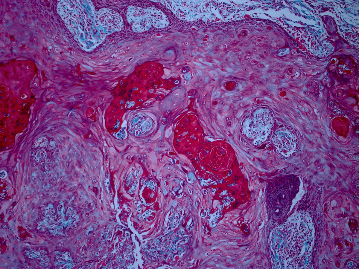 Art of the Stain Voting - National Society for Histotechnology
