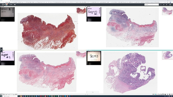 An In Depth Look at the Hematoxylin & Eosin (H&E) Stain: Part 2