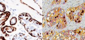 IHC Past, Present, and Future