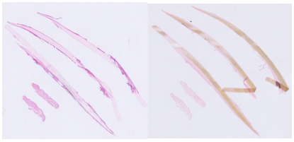 Nail Protocol: From H&E to IHCs Getting Nails to Stick