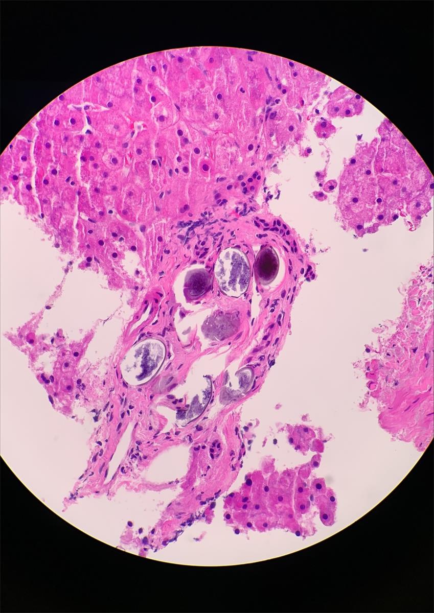 Art of the Stain Voting - National Society for Histotechnology