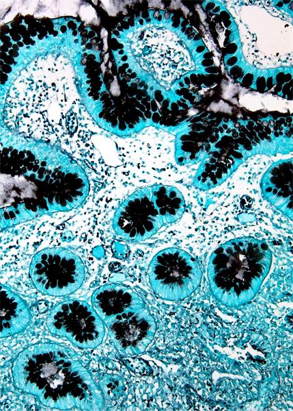 Art of the Stain Voting - National Society for Histotechnology