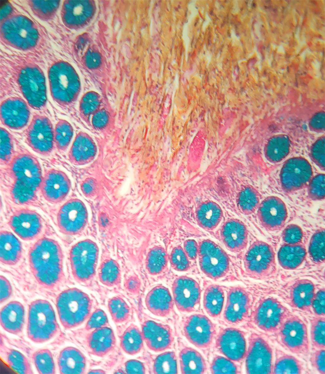 Art of the Stain Voting - National Society for Histotechnology