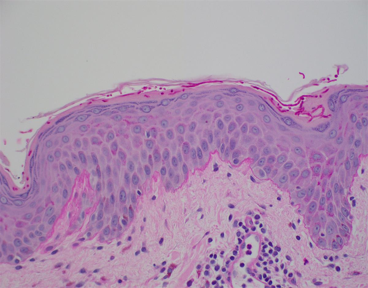 Art of the Stain Voting - National Society for Histotechnology
