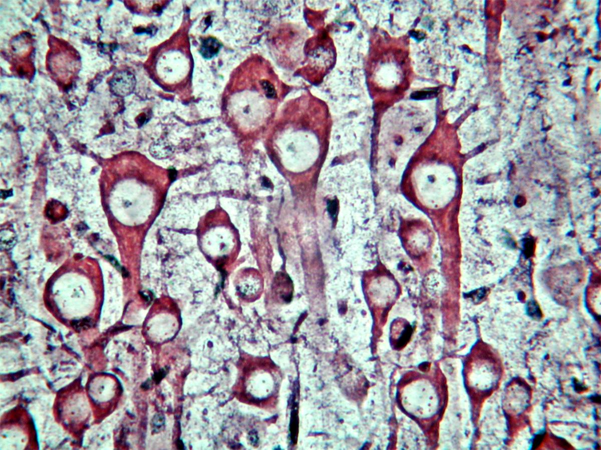 Art of the Stain Voting - National Society for Histotechnology
