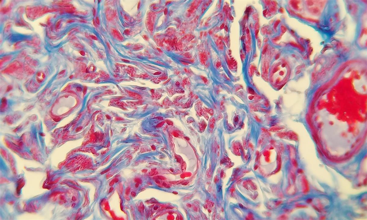 Art of the Stain Voting - National Society for Histotechnology