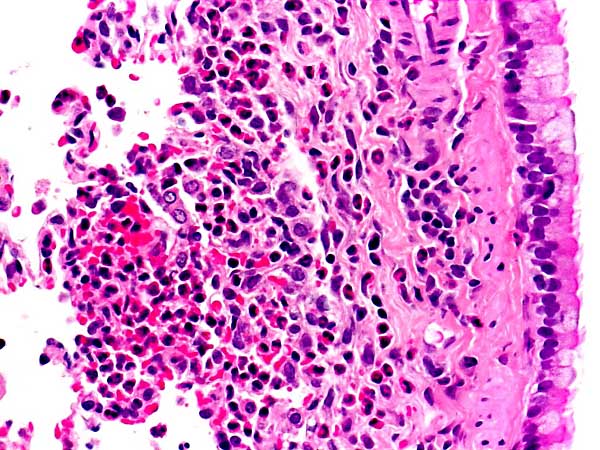 12 week old Sprague Dawley rats males and females