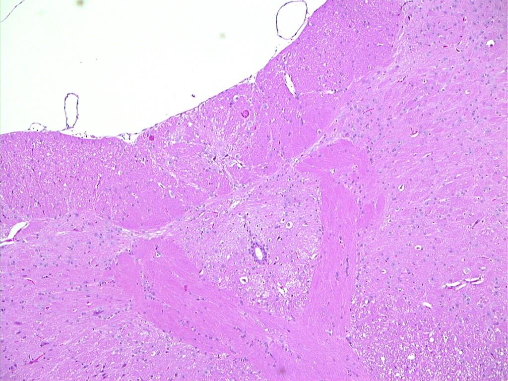 Beagles & CD-1 Mouse - spontaneous axonal spheroids
